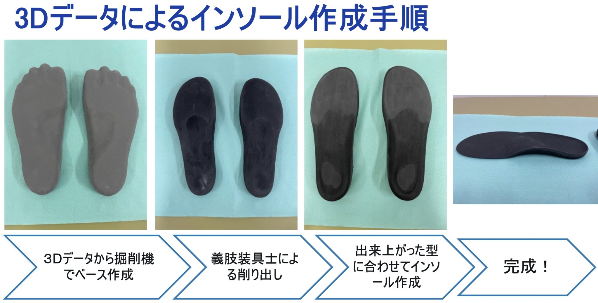 インソール療法｜近鉄生駒駅の形成外科・美容皮膚科｜なかにし形成外科クリニック