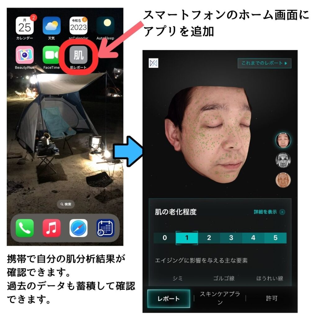 EVE-V(パノラマAI肌診断システム)｜近鉄生駒駅【奈良】の形成外科・美容皮膚科｜なかにし形成外科クリニック
