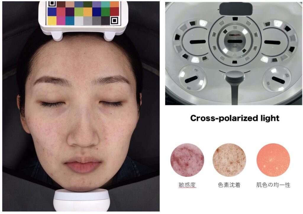 EVE-V(パノラマAI肌診断システム)｜近鉄生駒駅【奈良】の形成外科・美容皮膚科｜なかにし形成外科クリニック